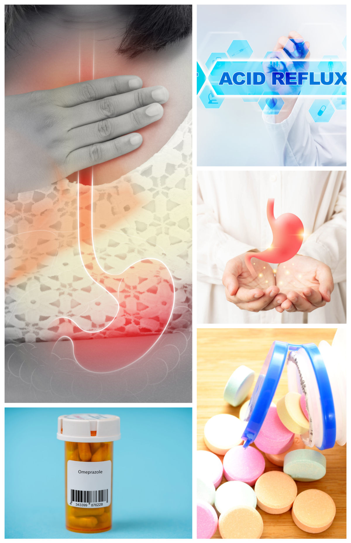 PREVENTION SERIES: Acid Reflux - Merus Gastro