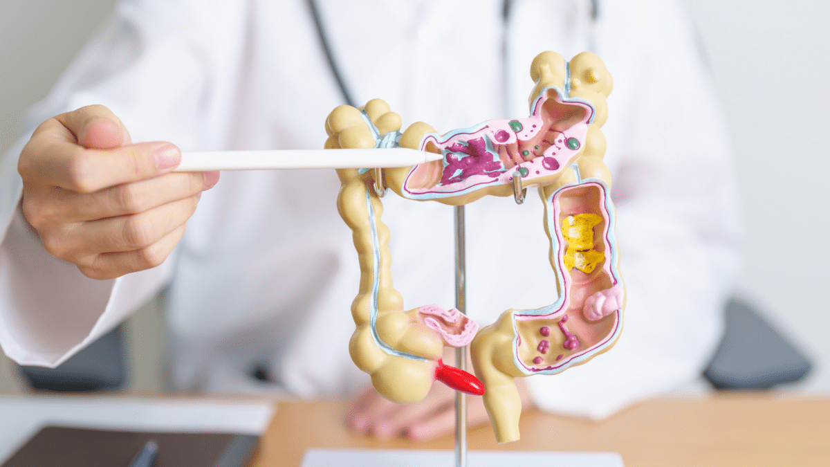 IBD Specialists Near Me, IBD Doctors & Ulcerative Colitis Treatment in ...