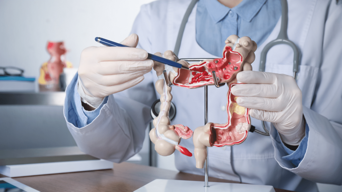 IBD Specialists Near Me, IBD Doctors & Ulcerative Colitis Treatment in ...